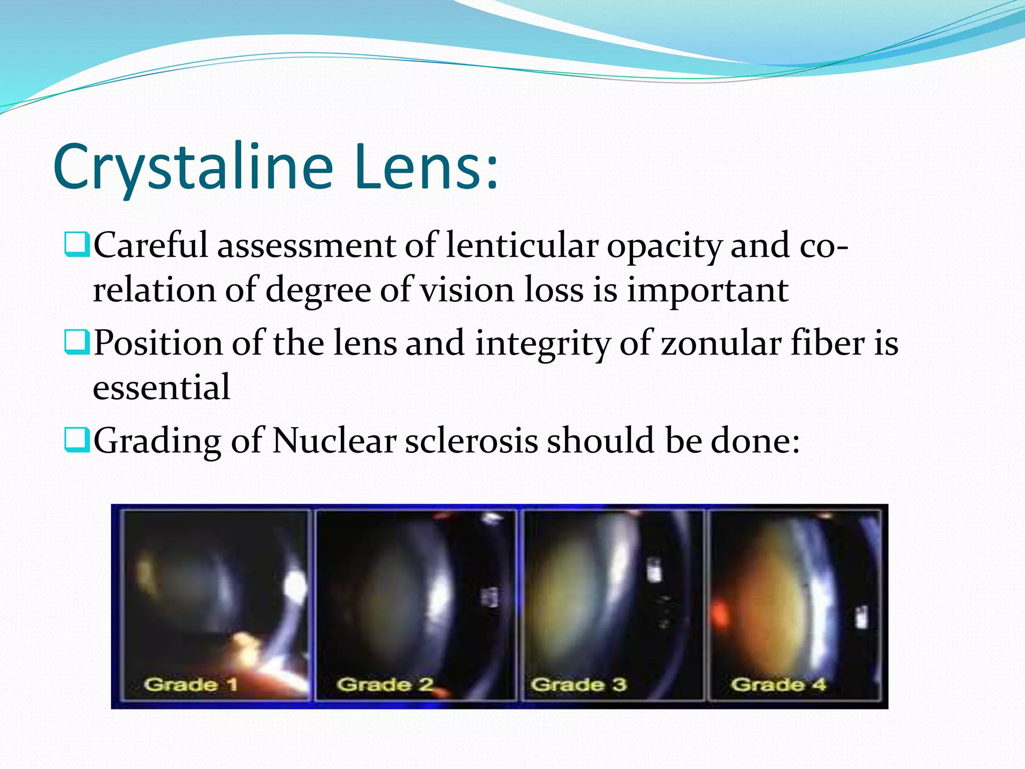 Cataract Evaluation Ppt Pptx