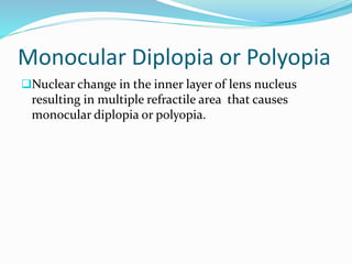 Cataract evaluation ppt | PPTX