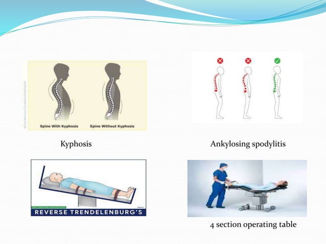 Cataract Evaluation Ppt Pptx