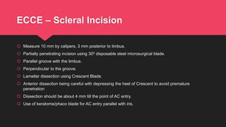 Cataract extraction (manual) and cataract surgery | PPTX