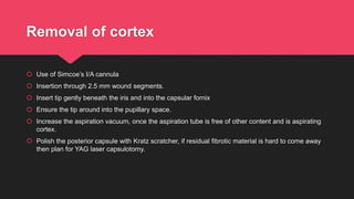 Cataract extraction (manual) and cataract surgery | PPTX