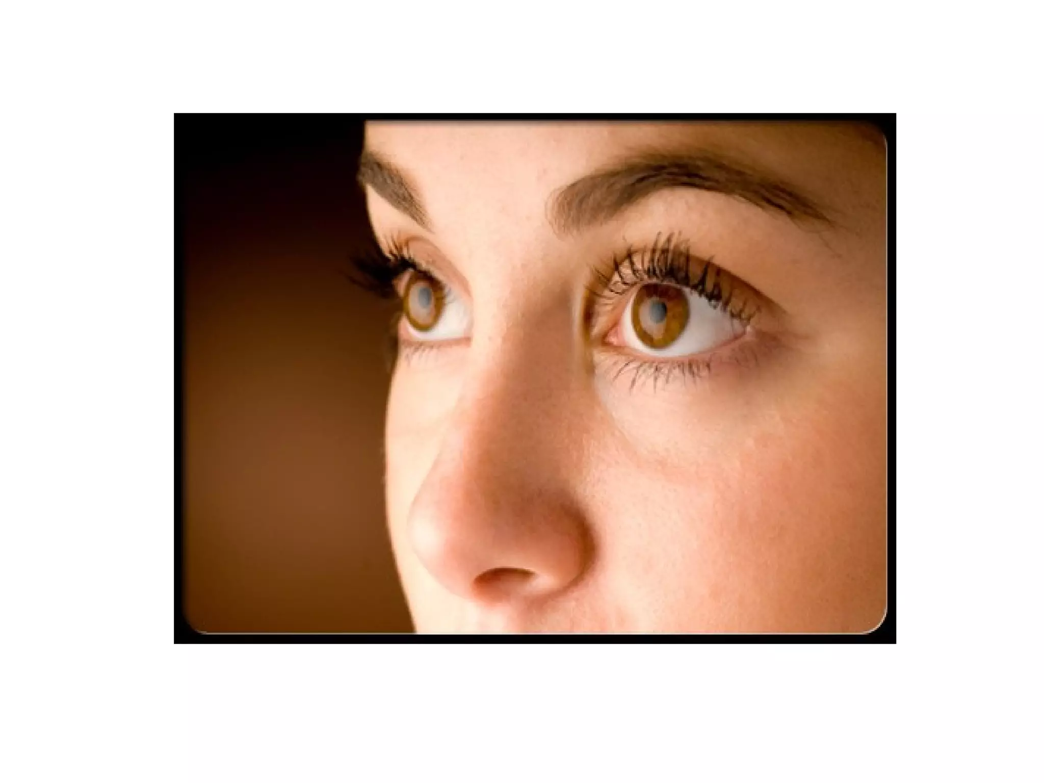 Cataract | PPT | Eye and Vision Conditions | Diseases and Conditions