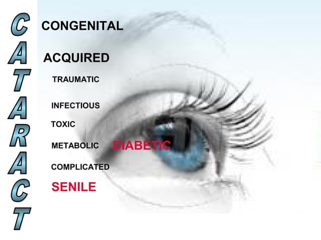 Cataract | PPT | Eye and Vision Conditions | Diseases and Conditions