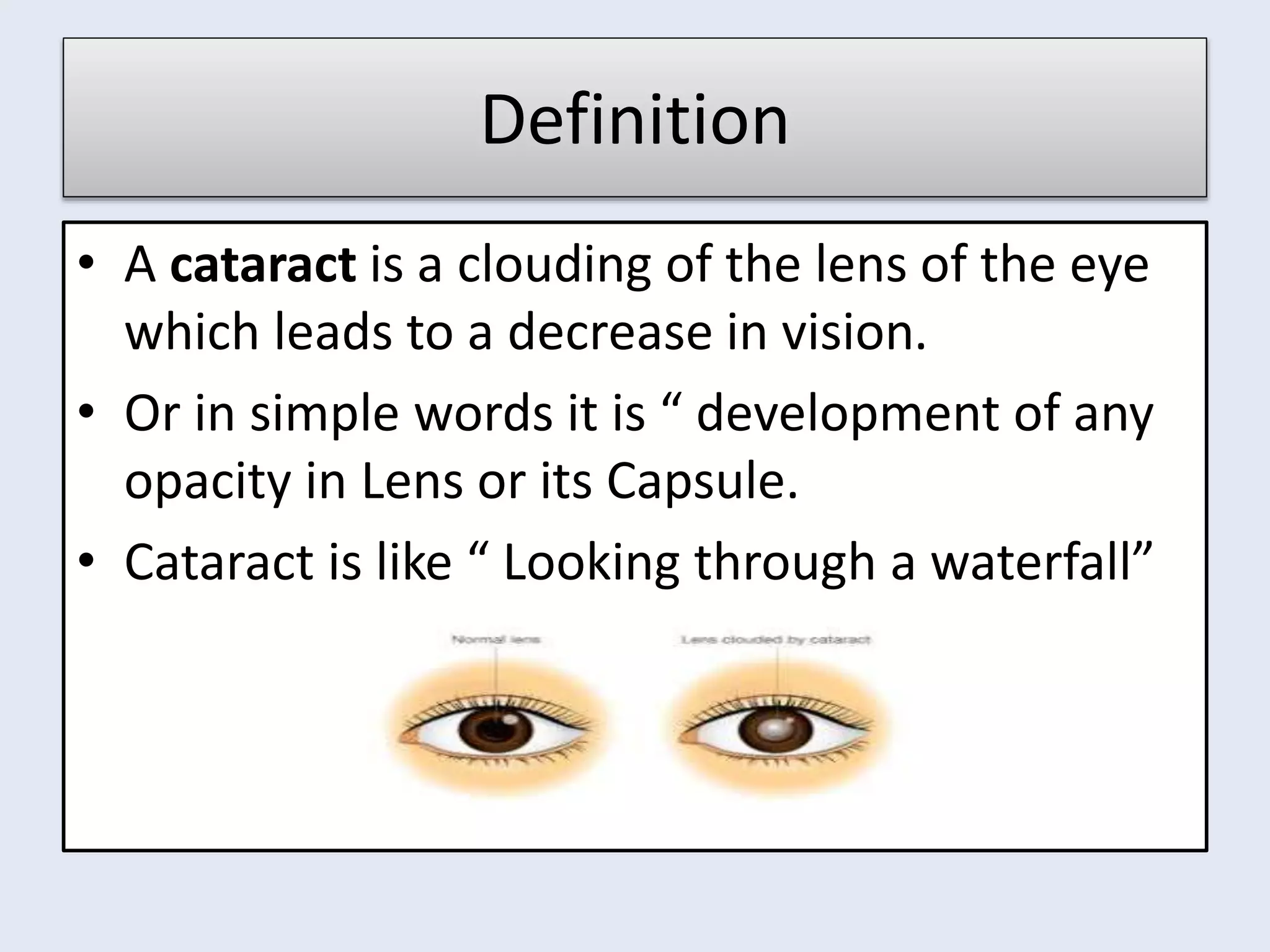 Types Of Cataract | PPTX