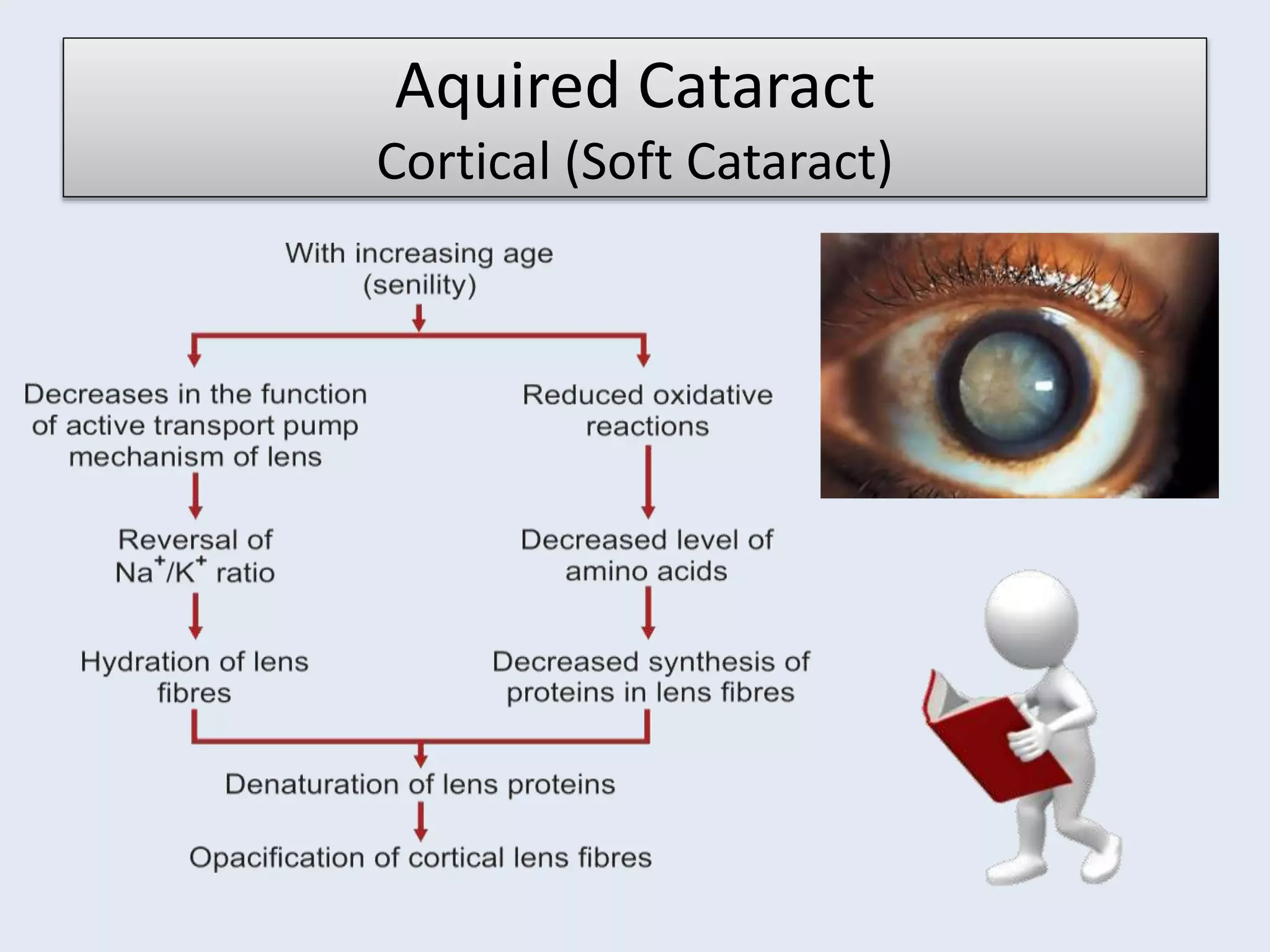 Types Of Cataract | PPTX