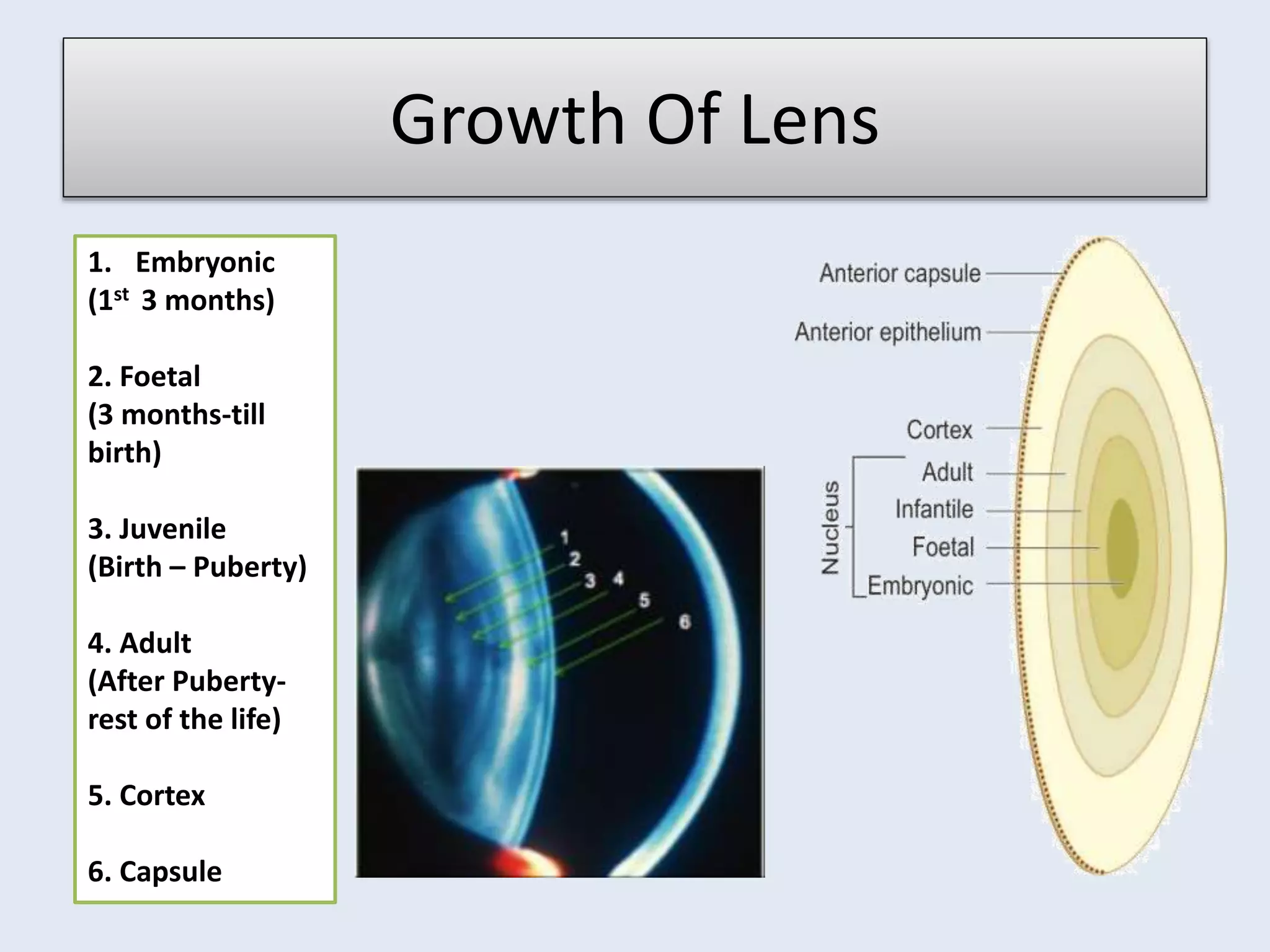 Types Of Cataract | PPTX