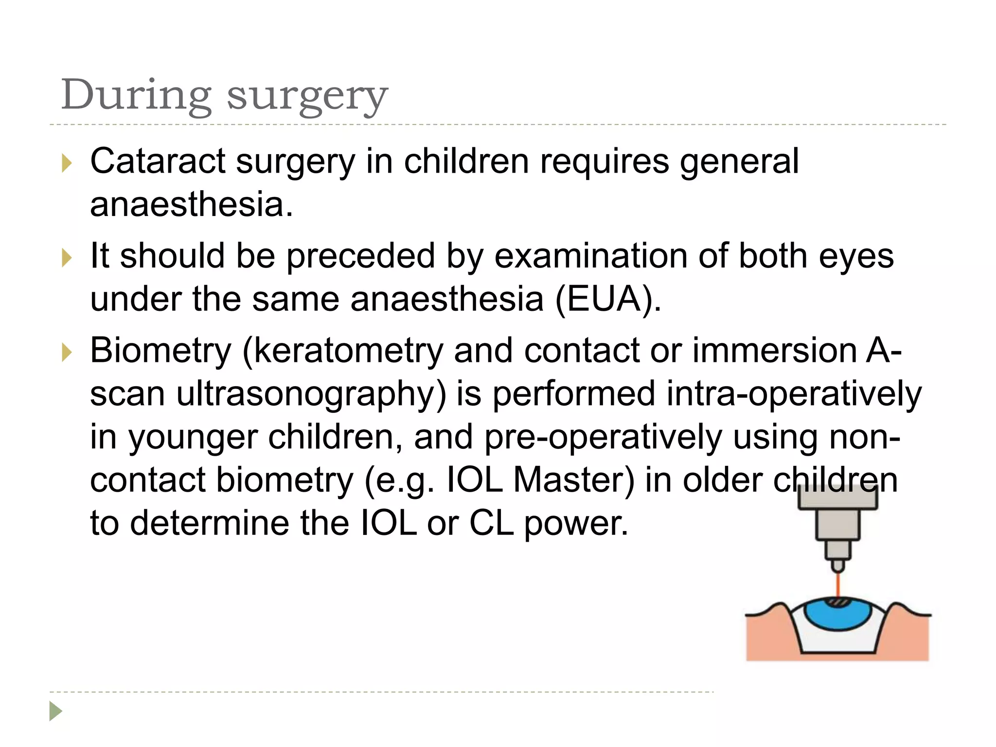 Cataract management in children from optometrist perspective | PPTX