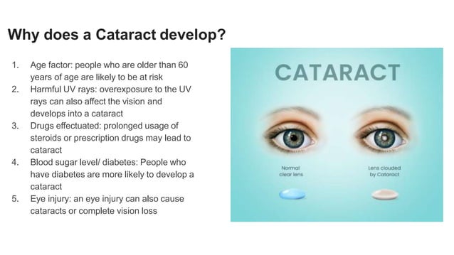 Eye Cataract ppt | PPTX | Eye and Vision Conditions | Diseases and ...