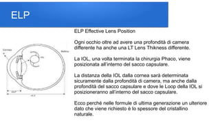 Diagnostic exams for a premium cataract surgery | PPTX