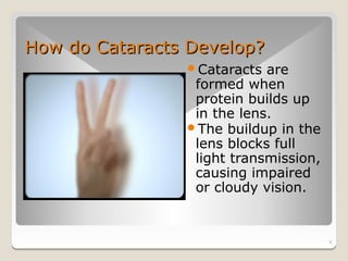 Cataract Surgery: The Path to Clear Vision | PPT