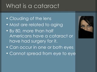 Cataracts | PPT