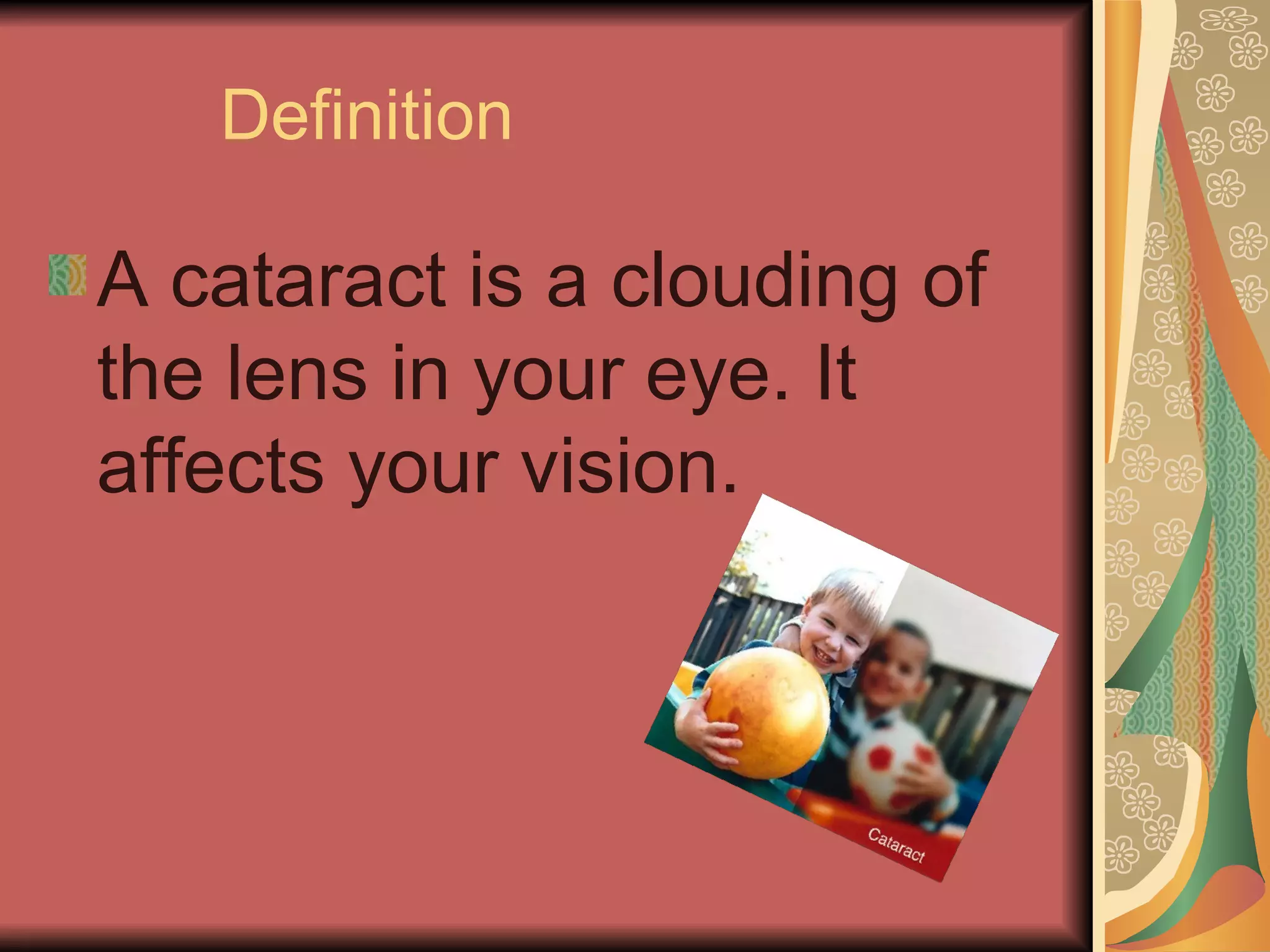 Cataracts | PPT
