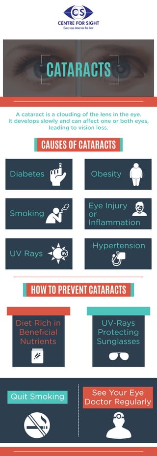 Cataracts | PDF