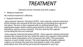 CATARACTS.pptx