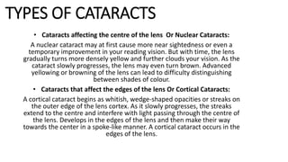 CATARACTS.pptx