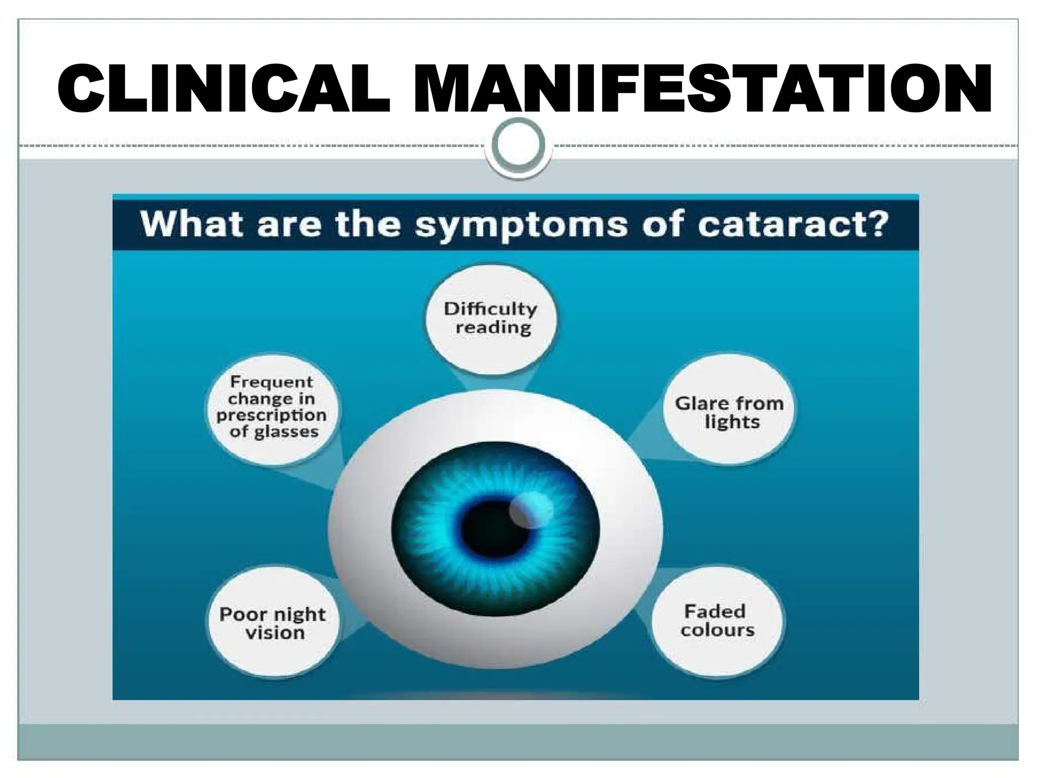 CATARACT SEMINAR PRESENTATION WITH PATHOPHYSIOLOGY | PDF