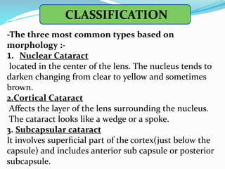 CATARACT SEMINAR PRESENTATION WITH PATHOPHYSIOLOGY | PDF