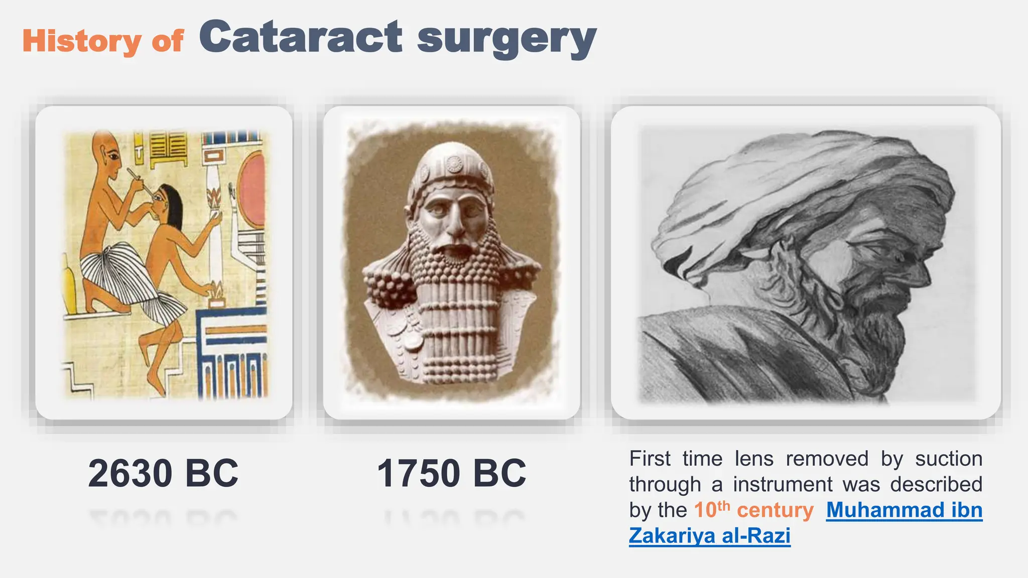 Cataract Slide .pptx