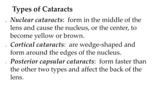CATARACTS NEW of the human eye and its management. | PPTX