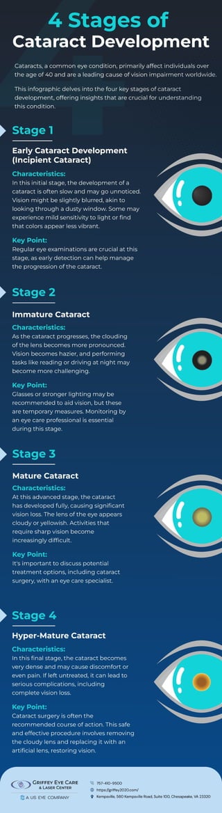 4 Stages of Cataract Development | PDF