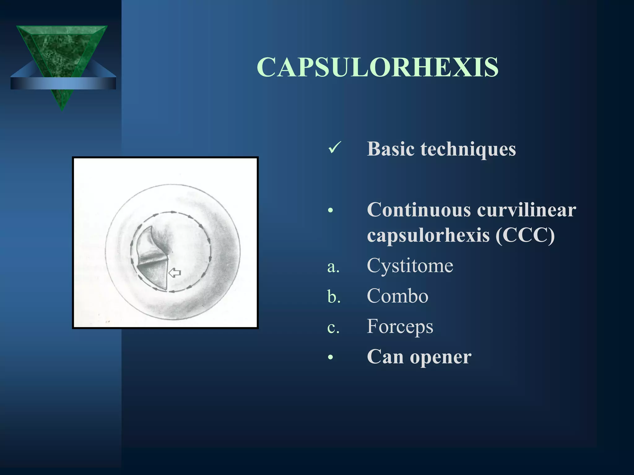 Cataract surgery | PDF