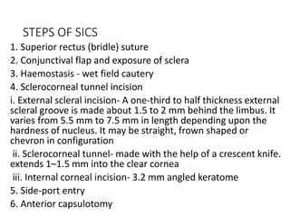 Cataract surgery | PPTX