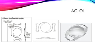 Cataract Surgery . IOL s.pptx types of IOLs | PPTX