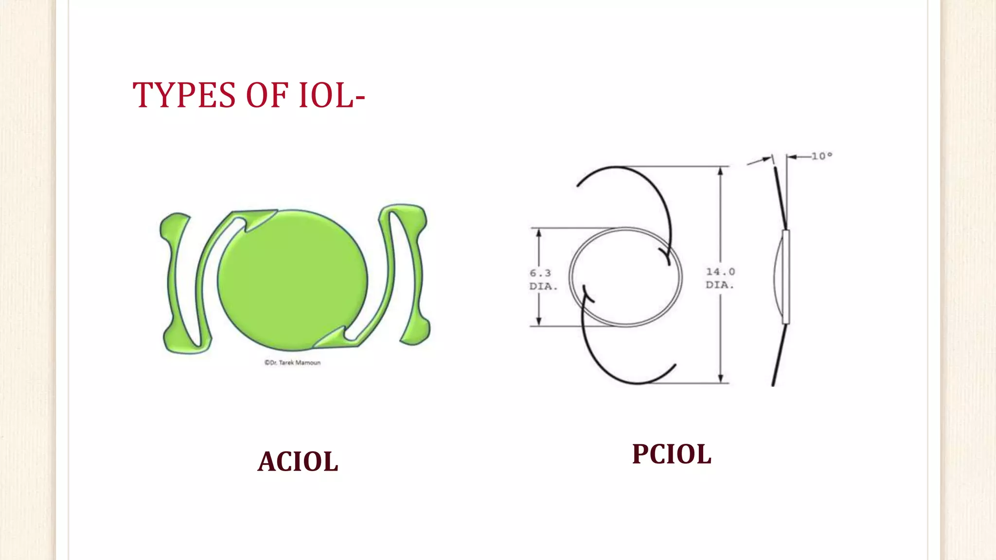 Cataract surgery past present future | PPTX
