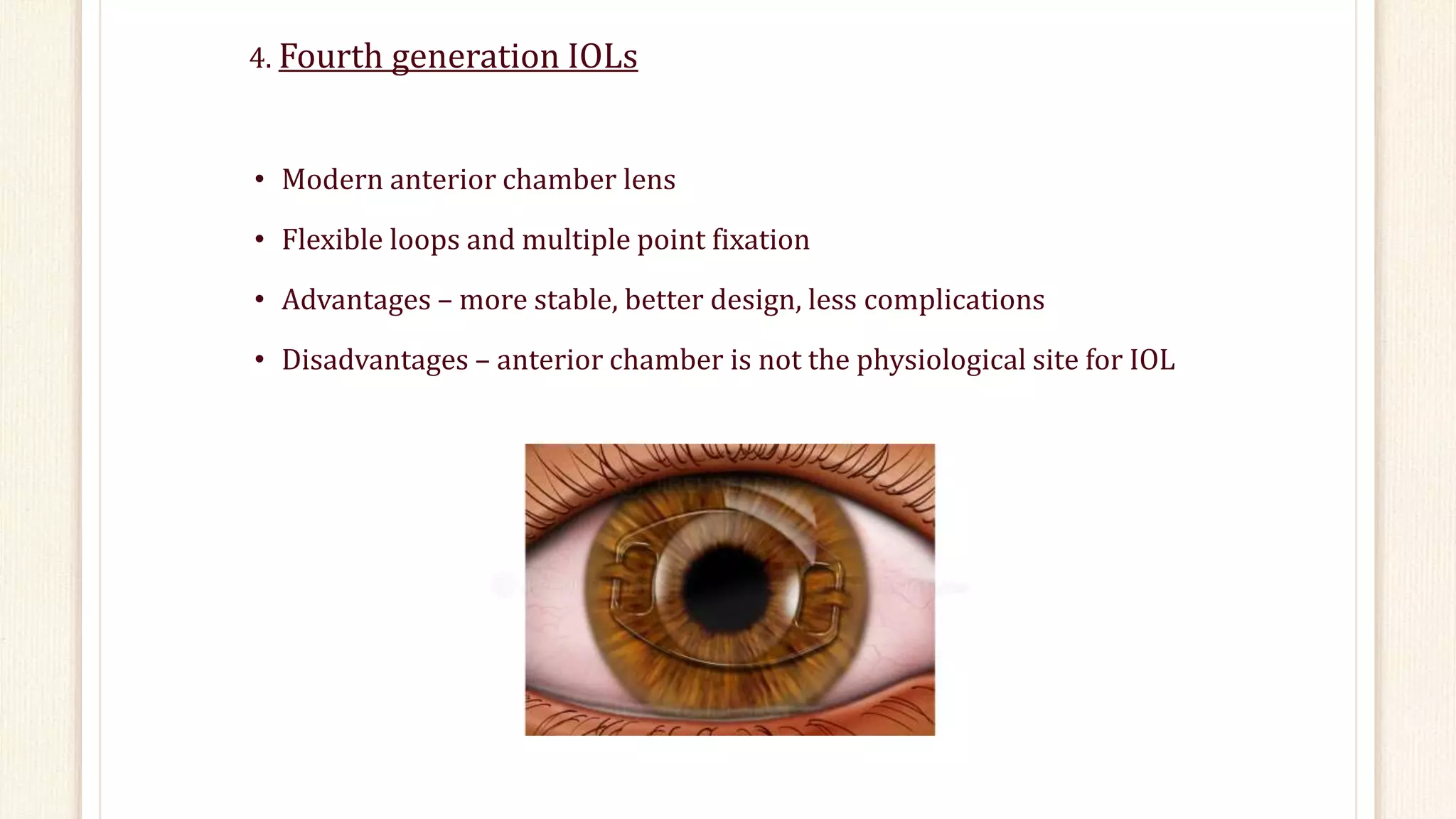 Cataract surgery past present future | PPTX
