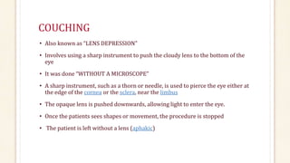 Cataract surgery past present future | PPTX