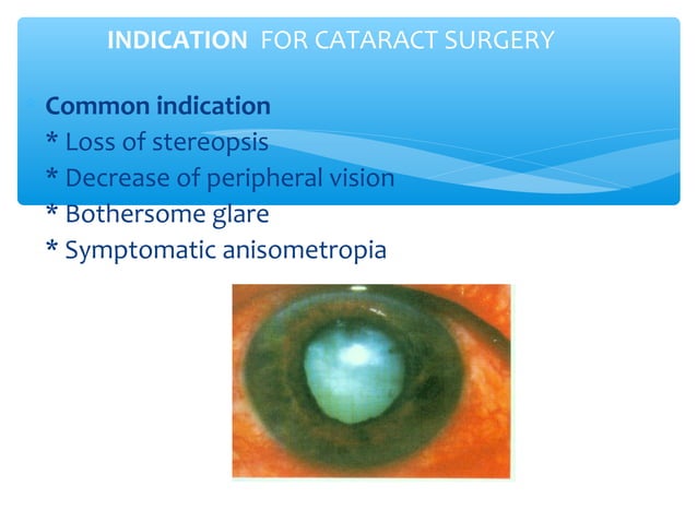 pre and post-operative management of cataract surgery | PPT | Eye and ...