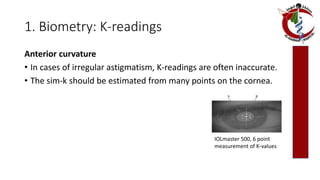 Cataract surgery for keratoconus patients | PPTX