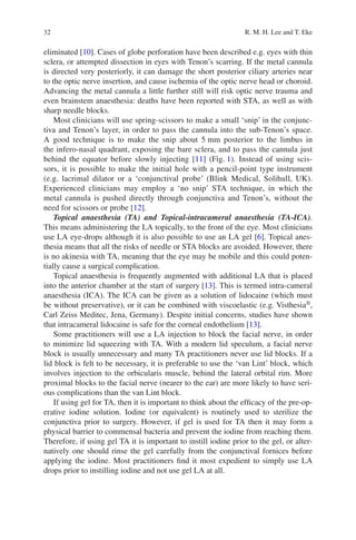Cataract Surgery Pearls and Techniques . | PDF
