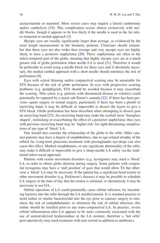 Cataract Surgery Pearls and Techniques . | PDF