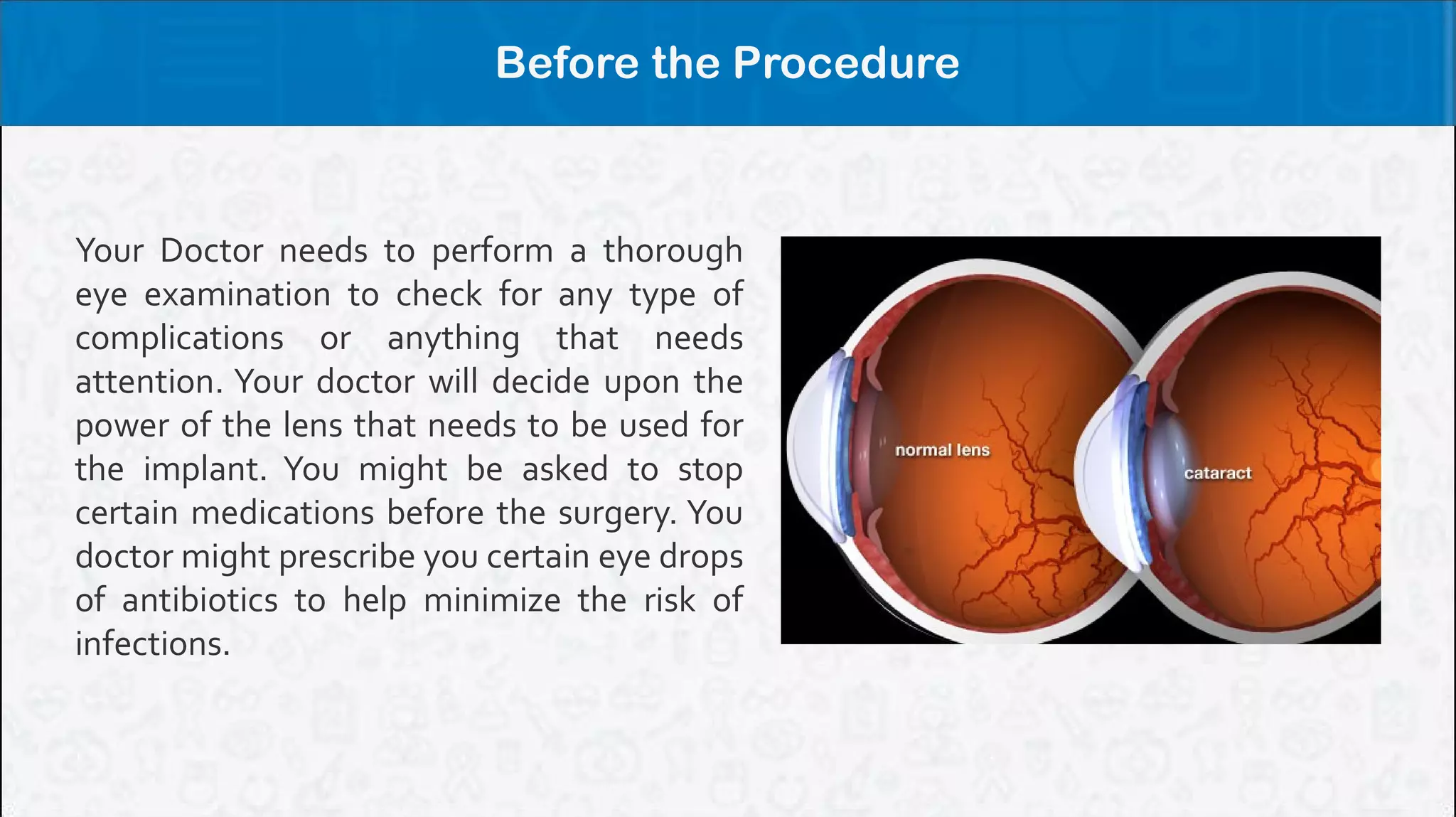 Cataract surgery ppt- Lyfboat | PPT