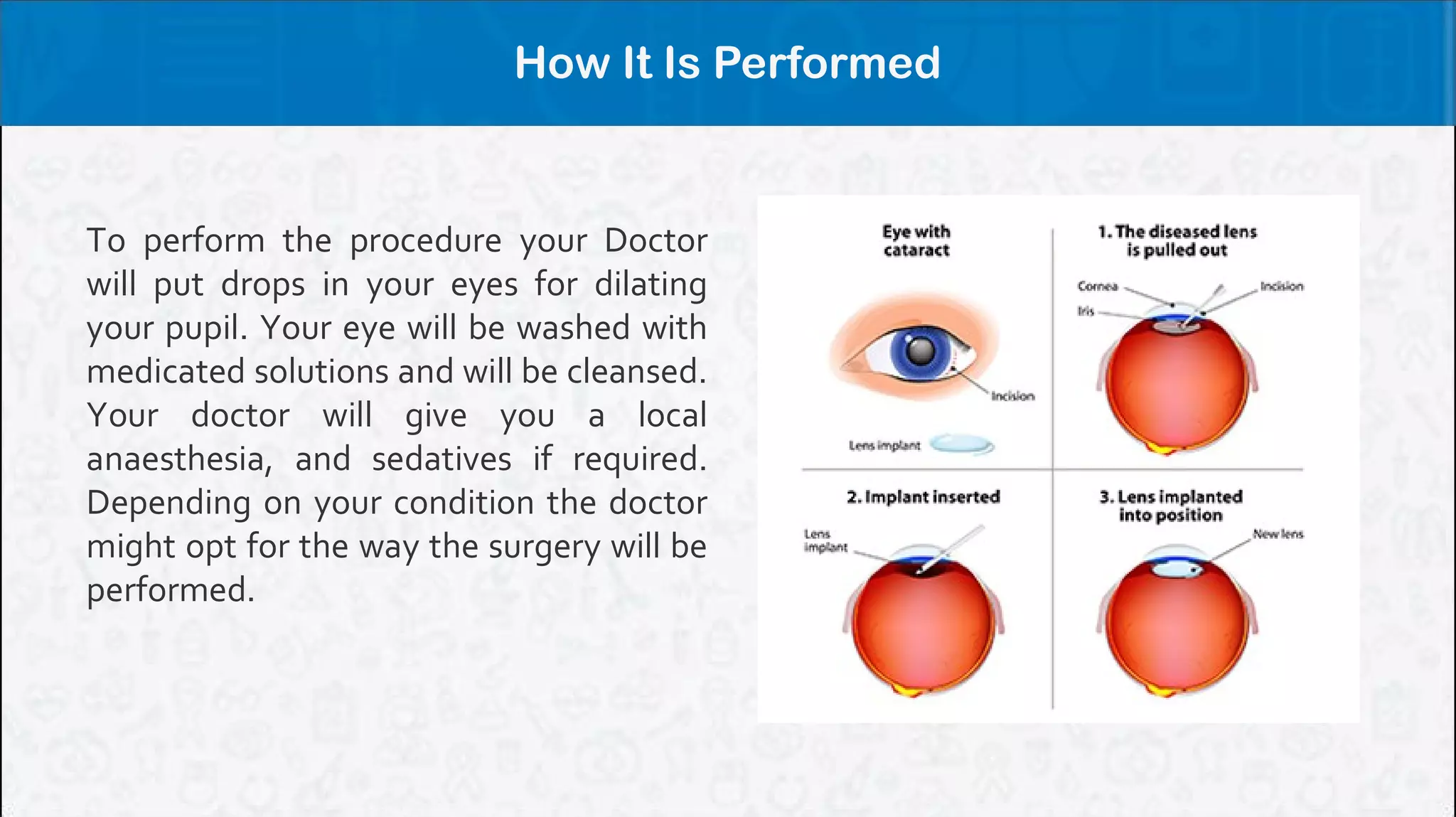 Cataract surgery ppt- Lyfboat | PPT