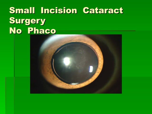 Cataract Surgical Techniques | PDF