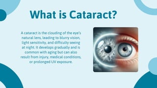 Cataract: Understanding the Causes and Symptoms | PDF