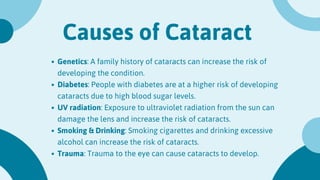 Cataract: Understanding the Causes and Symptoms | PDF