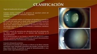 presentacion clinica de catarata en pacientes | PPTX