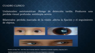 CATARATA CONGENITA ROTACION OFTALMOLOGIA PEDIATRICAINSN.pptx