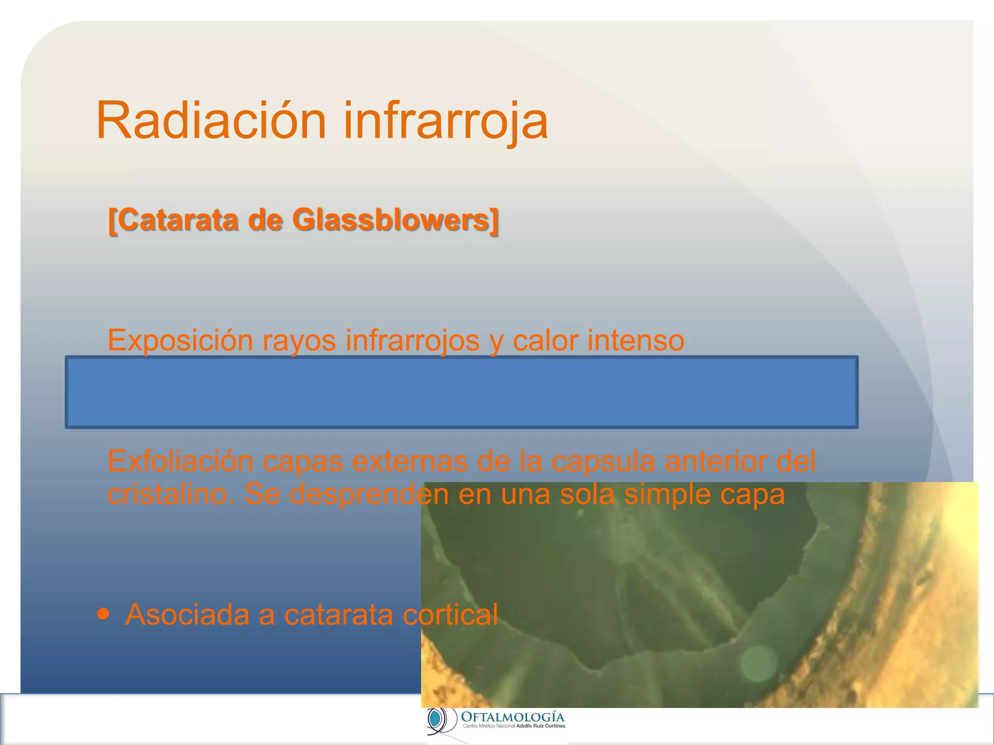 Catarata intumescente y secundaria manejo y tratamiento | PPTX