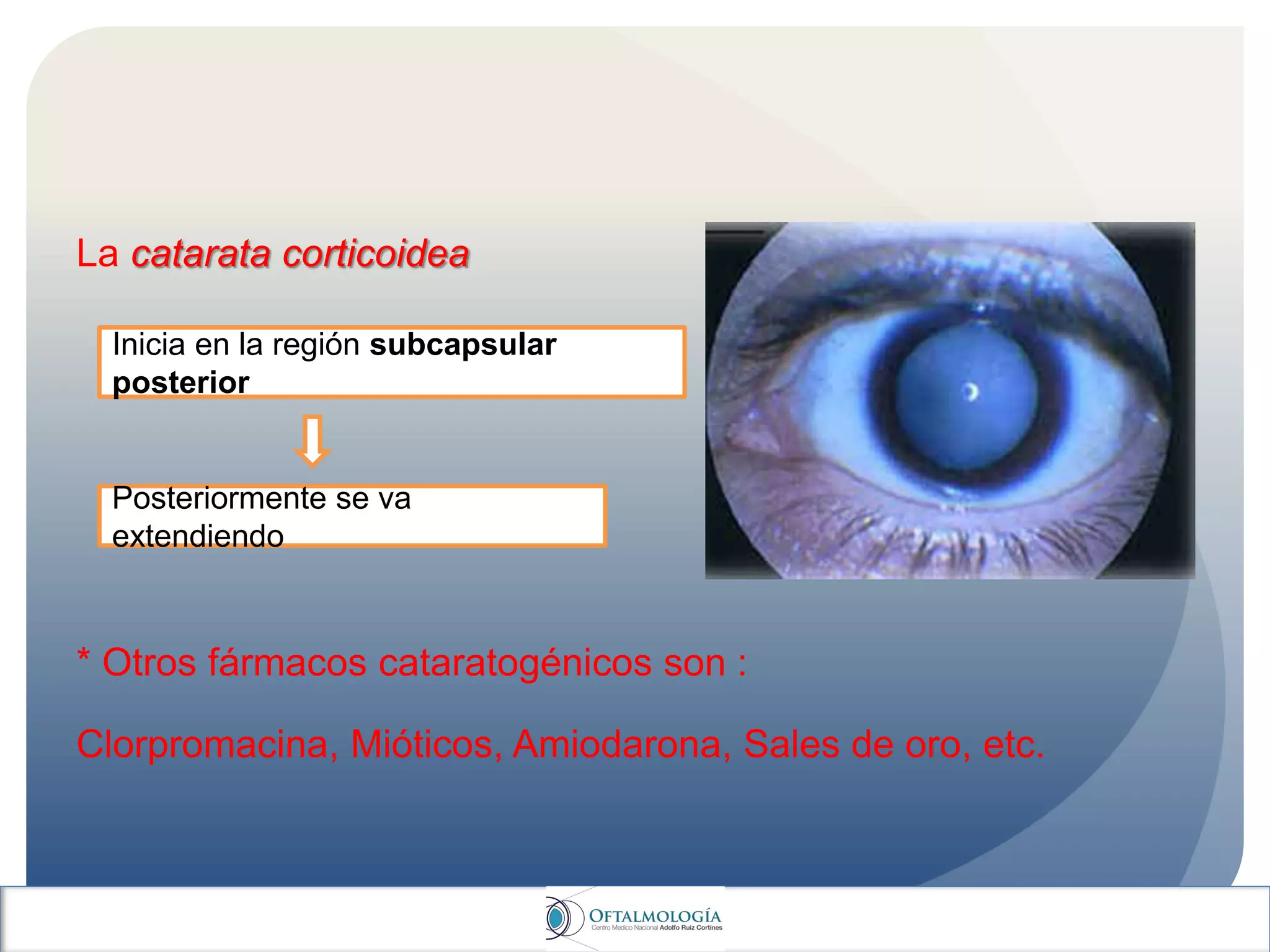 Catarata intumescente y secundaria manejo y tratamiento | PPTX