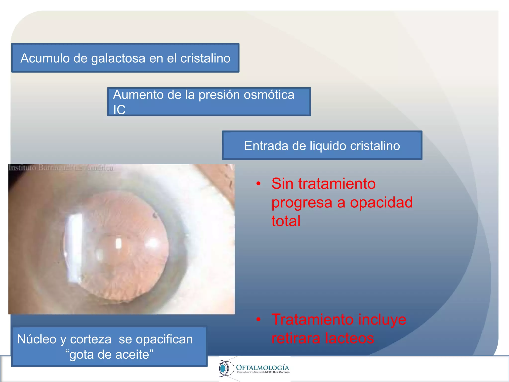 Catarata intumescente y secundaria manejo y tratamiento | PPTX