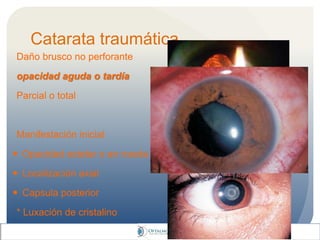 Catarata intumescente y secundaria manejo y tratamiento | PPTX
