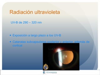 Catarata intumescente y secundaria manejo y tratamiento | PPTX