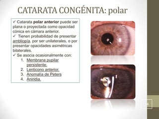 Cataratas | PPTX