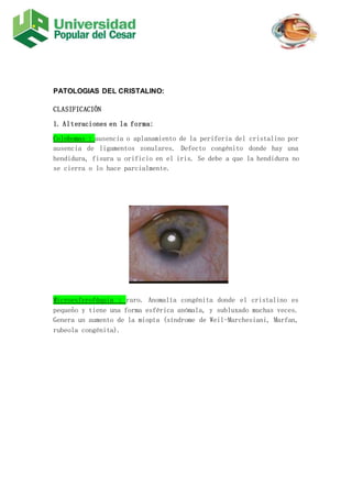 Cataratas técnica quirurgicas | DOCX