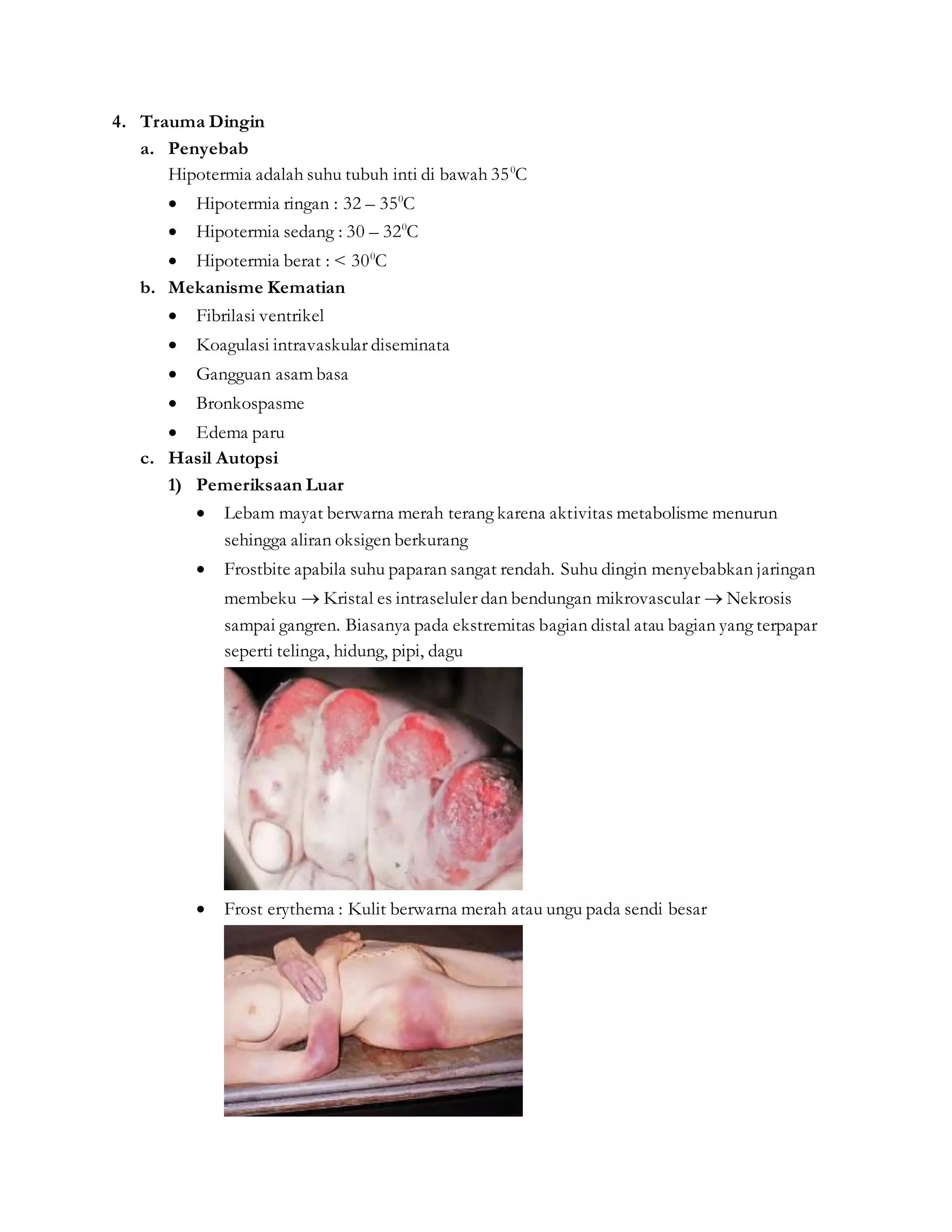 Forensik - Traumatologi | DOCX