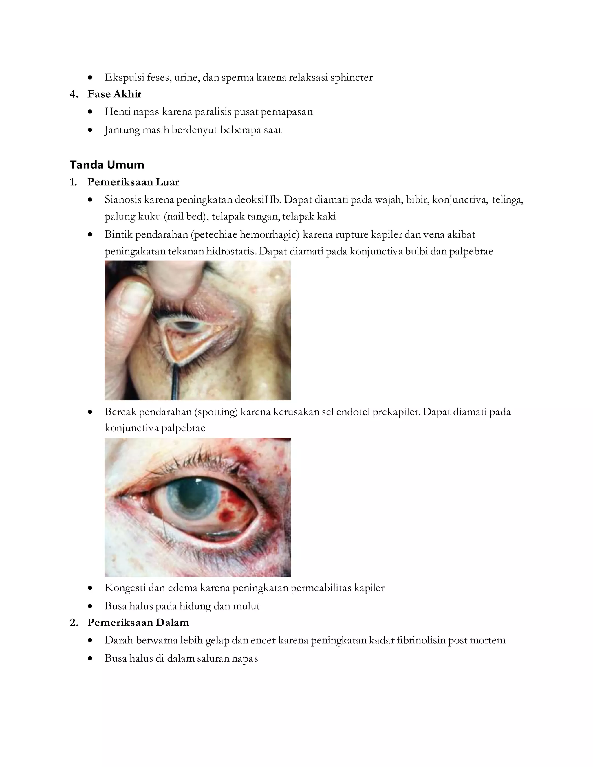 Forensik - Traumatologi | DOCX